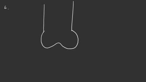 SOLVED:Visit this site (http://openstaxcollege.org/1/ kneesurgery) to perform a virtual knee ...