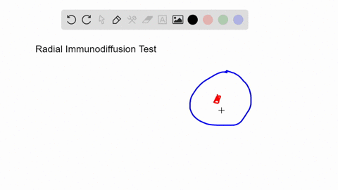 SOLVED:The radial immuno diffusion test quantifies antigen by mixing ...