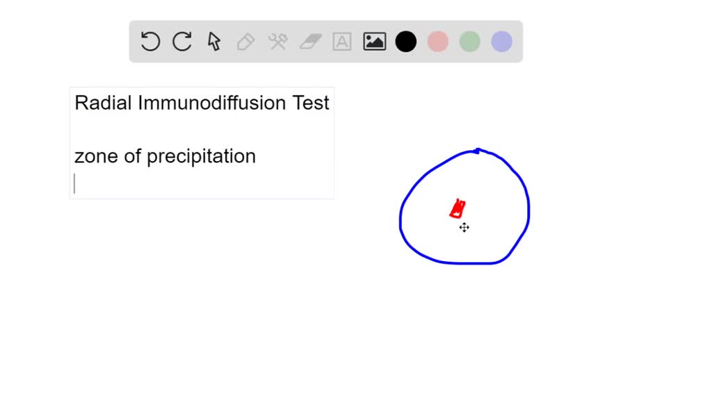 SOLVED:The radial immuno diffusion test quantifies antigen by mixing ...