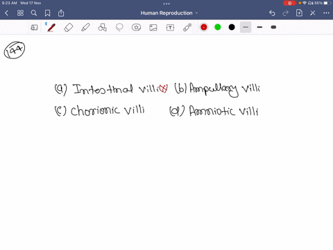 SOLVED:After implantation the finger-like projection which appears on ...