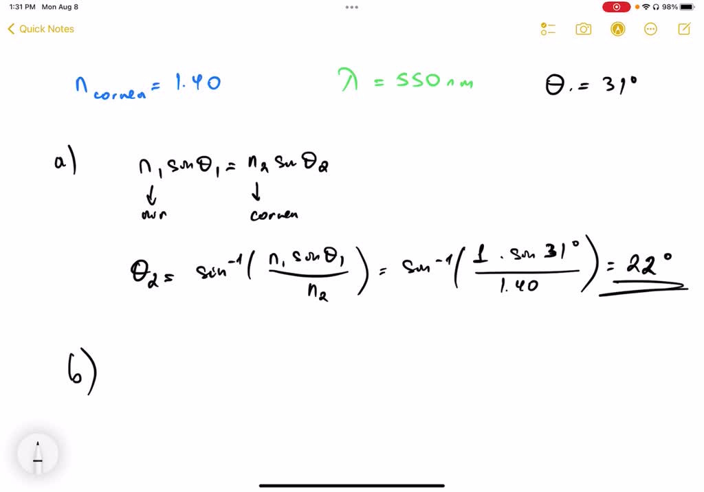 The refractive index of a human cornea is 1.40. If 550-nm light strikes ...