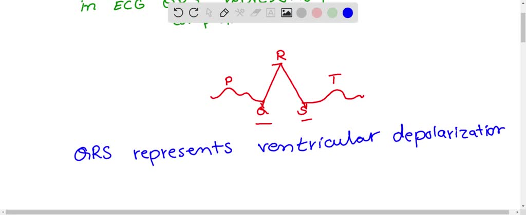 QRS complex represents the (a) Depolarization of ventricles (b ...