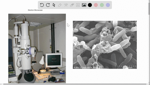 SOLVED:Why is an electron microscope useful when studying bacteria? A ...