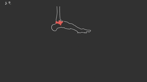 SOLVED:What structure contributes to the knee joint? a. lateral ...