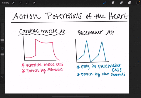 SOLVED:What characteristic of the SA node distinguishes it from other ...