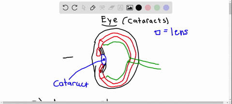 SOLVED:Humans have single-lens eyes that focus by changing shape. In ...