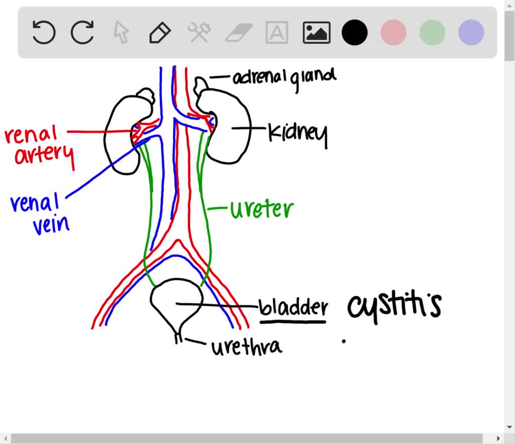 SOLVED:In the figure shown here, where would cystitis occur?