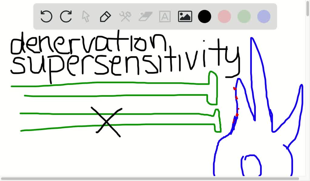 SOLVED:Is denervation supersensitivity a change in axons or dendritic ...