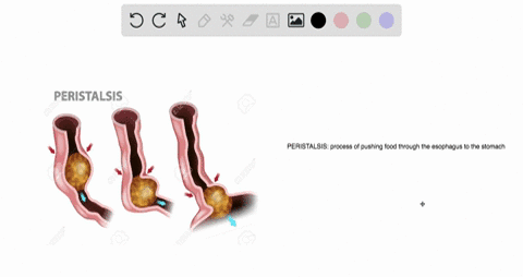 SOLVED:The lining of intestinal wall from outside to inside is made up ...
