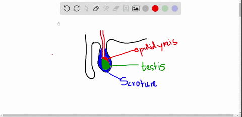 Optimal management of bilateral undescended testicles in an infant is a ...