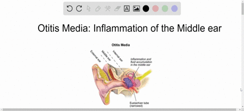 Which term means "inflammation of the middle ear"? otitis...