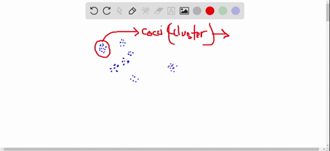 SOLVED:The microscopic growth pattern shown is characteristic of which ...