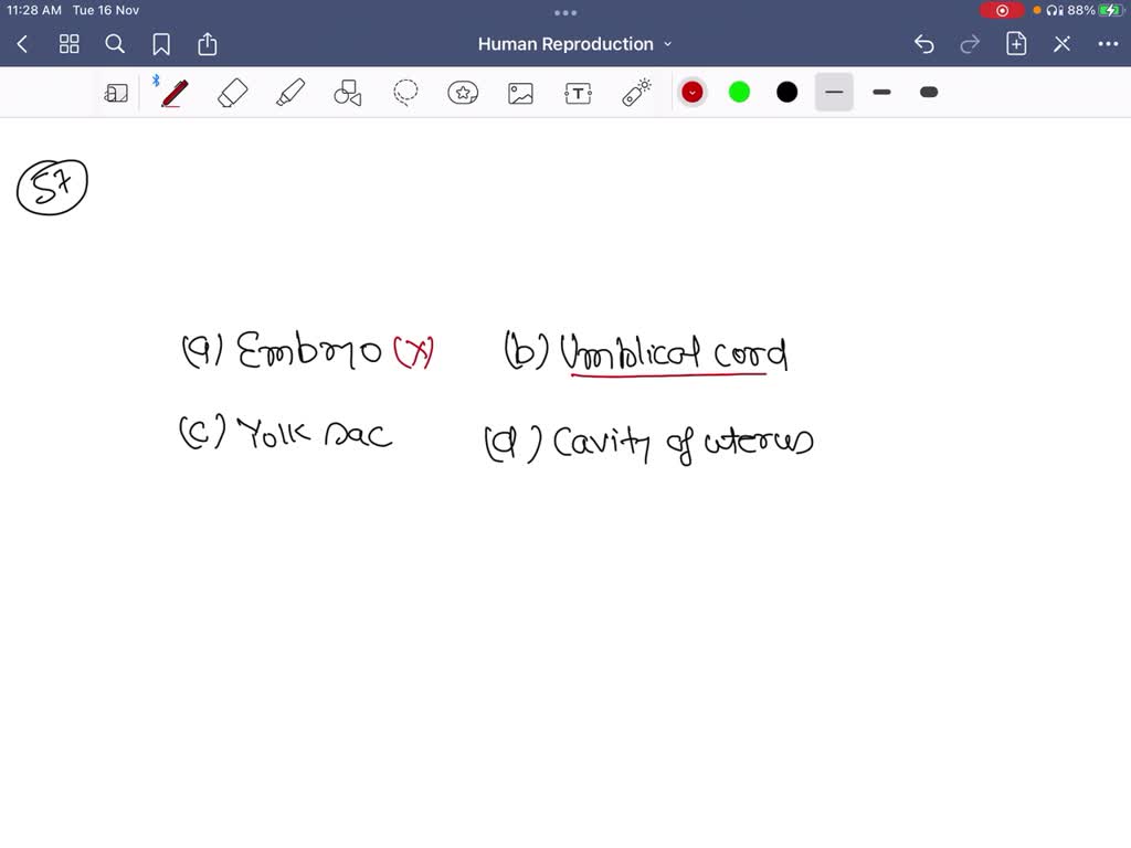 The developing baby is attached by the umbilical cord to the a. cervix ...