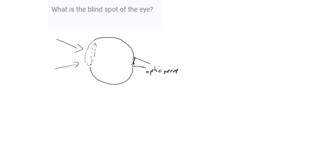 SOLVED: apa perbedaan antara bintik kuning dan bintik buta pada mata